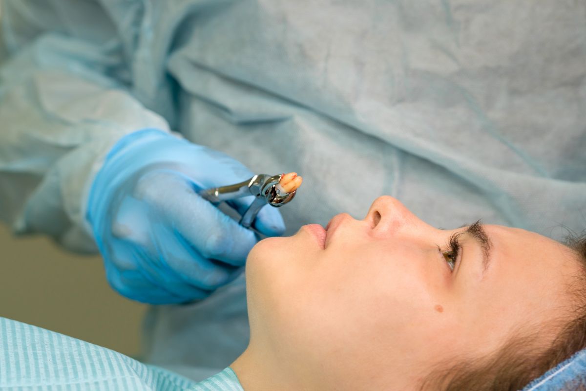 When Can You Brush Your Teeth After a Tooth Extraction?