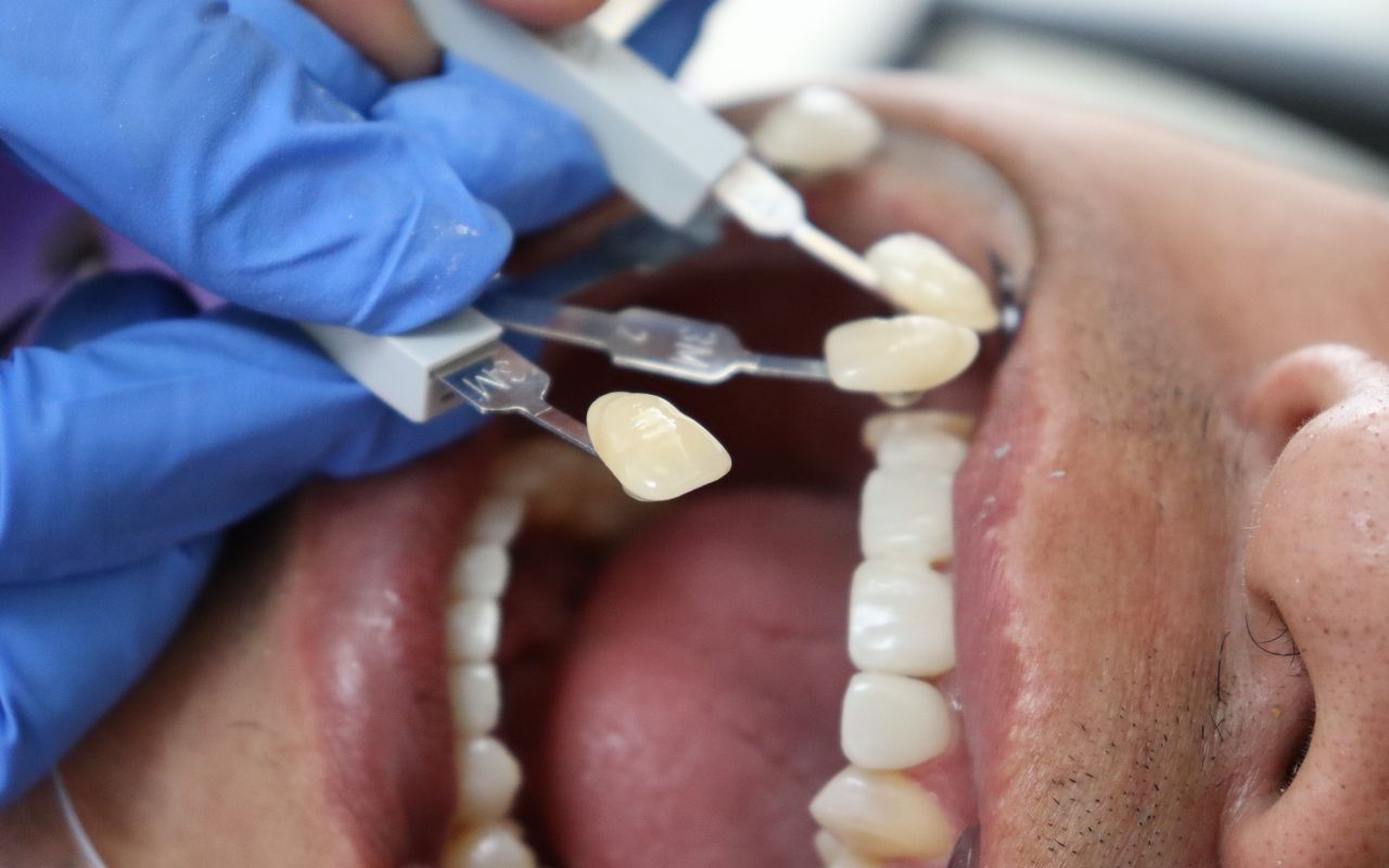 Can a Swallowed Dental Crown Be Reused? What Patients Should Know